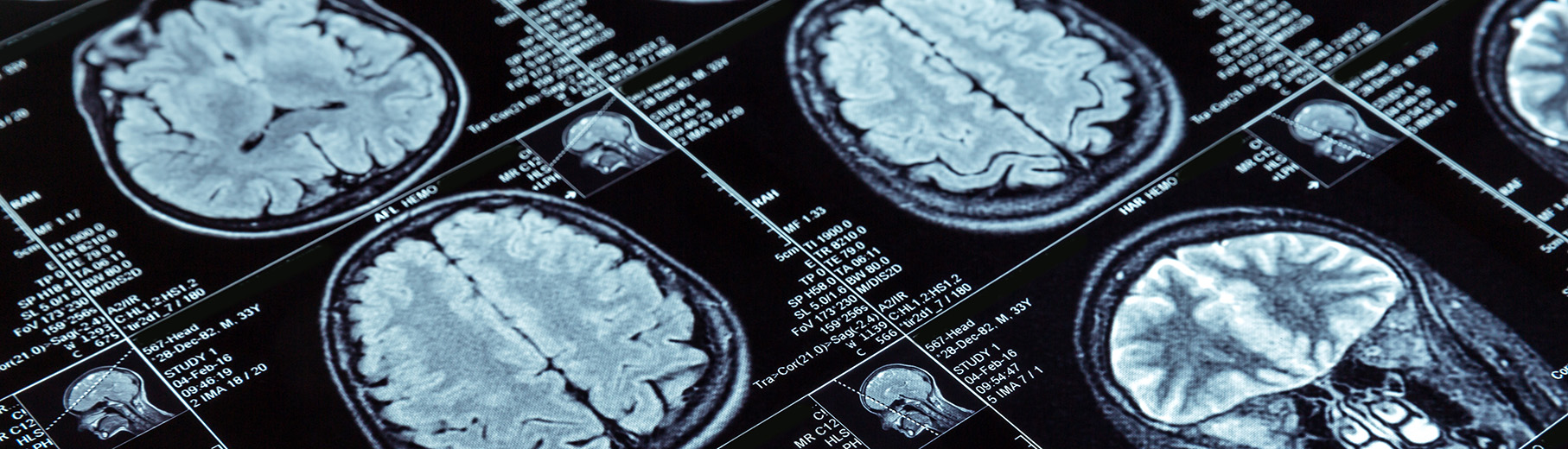 The PACS unit - receiving imaging | Shaare Zedek Medical Center
